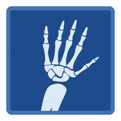 Hand Bones X Ray Effect Animation GIF | GIFDB.com