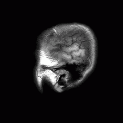 Radiology Xray Scanners GIF | GIFDB.com